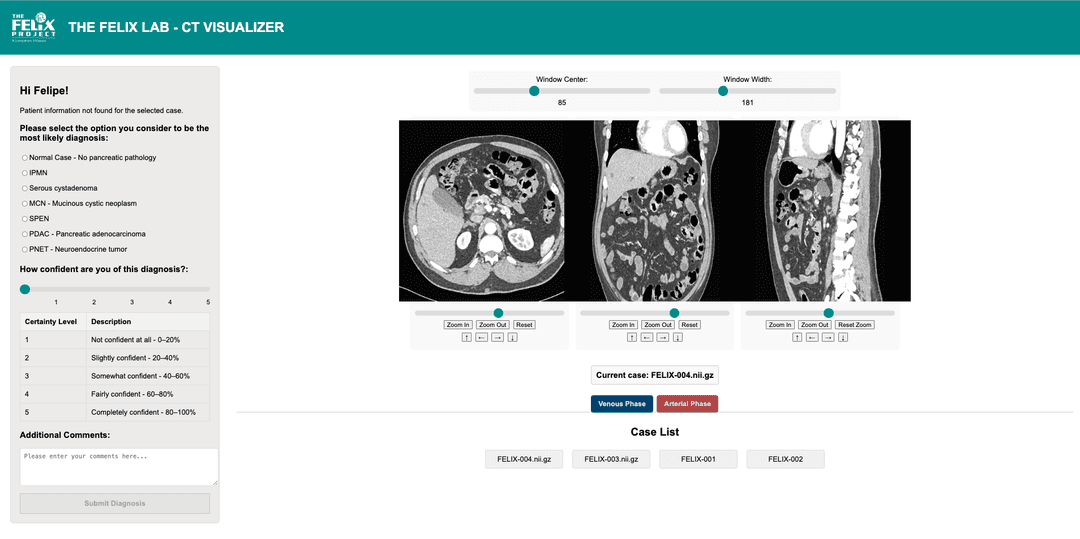 Felix Lab - Advancing Pancreatic Cancer Research