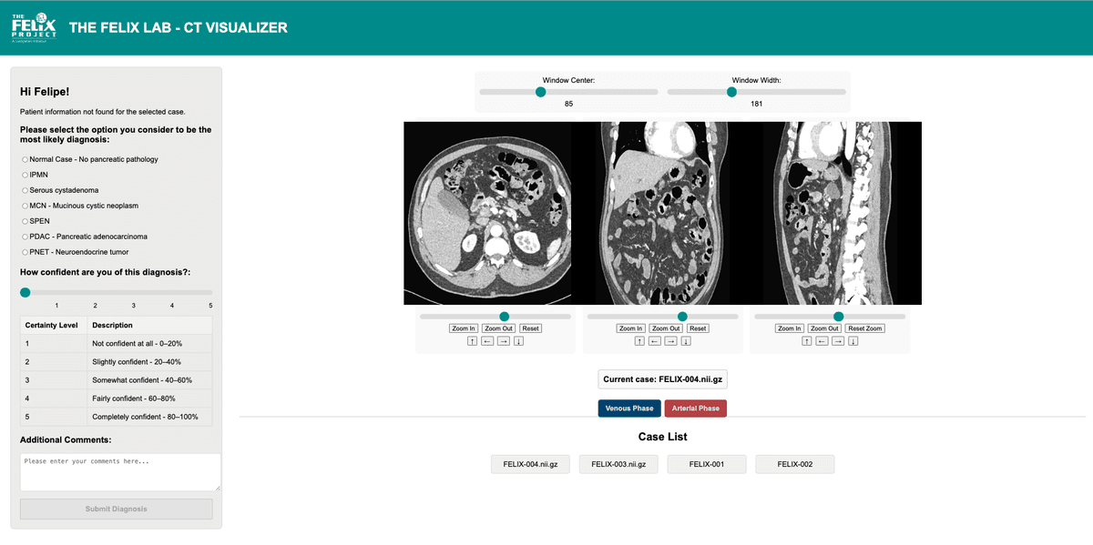 Felix Lab - Advancing Pancreatic Cancer Research