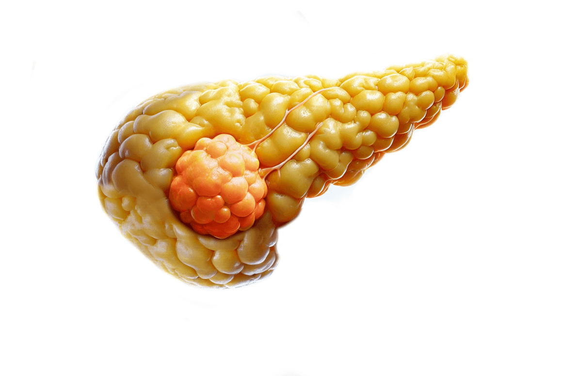 Felix Lab - Advancing Pancreatic Cancer Research